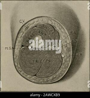 Chirurgie opératoire, pour les étudiants et les praticiens . par le ...