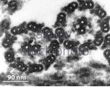 Image au microscope électronique à transmission d'une section fine cut ...