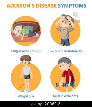 Infographie médicale sur les symptômes de la maladie d'Addison Image ...