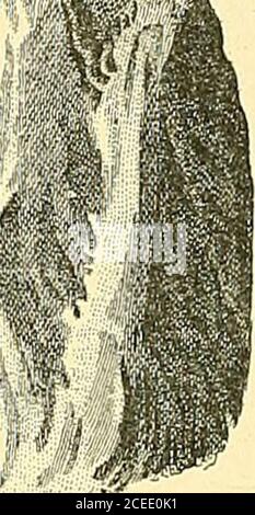 . L'anatomie et le traitement chirurgical de la hernie. MESURES ...