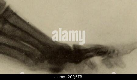 . Anatomie et pathologie vivantes; . TÔLE 179. DÉPLACEMENT VERS L ...