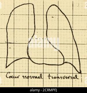 . Les formes de l'aire de projection du coeur pathologique : étude de ...