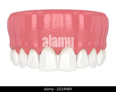 La mâchoire humaine avec l'anatomie des dents et des gencives en illustration médicale modèle ...