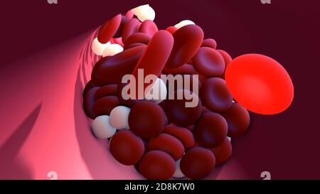 Caillot de sang et de thrombose concept illustration médicale comme un ...