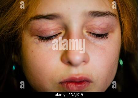 petite fille triste après avoir pleuré. Pleurs petite belle fille avec ...