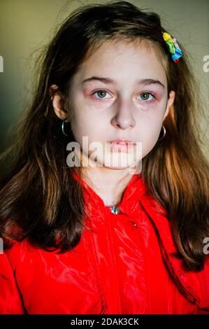 petite fille triste après avoir pleuré. Pleurs petite belle fille avec ...
