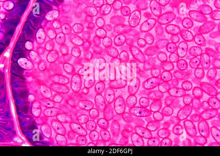 Coupe transversale d'ascaris Photo Stock - Alamy