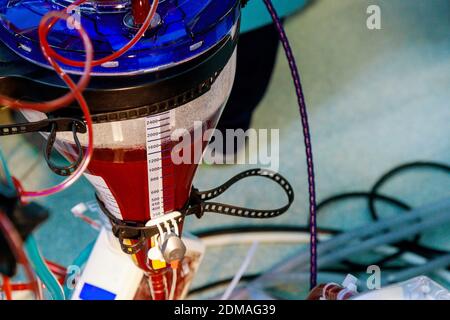 Appareil circulation sanguine appareil de poumon cardiaque pour la ...