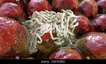 Vers ronds dans l'intestin humain, illustration informatique. Les vers ...