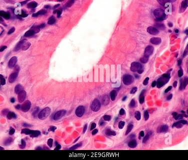 La muqueuse de l'estomac. La lumière microphotographie (en bas à gauche ...