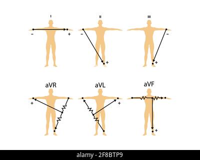 Triangle ECG Einthoven, y compris illustration de la dérivation ...
