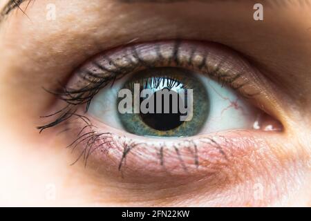 Pupille dilatée. Close-up d'un œil humain avec une pupille dilatée ...