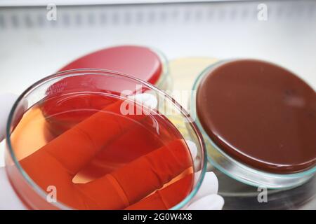 La gélose MacConkey est un milieu de culture sélectif et différentiel ...