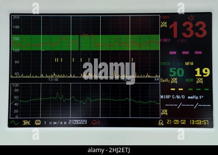 Appareil de cardiographie électronique surveillance des contractions ...
