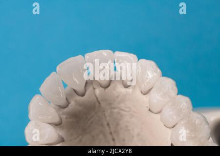 Modèle anatomique de la mâchoire supérieure humaine avec dents isolé ...