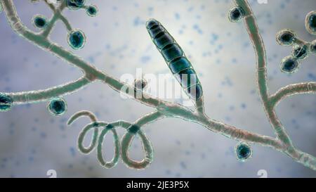 Champignons Trichophyton mentagrophytes, la cause du pied de l'athlète ...