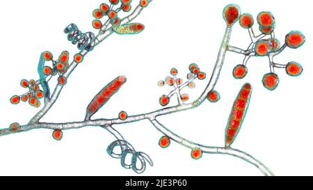 Champignons Trichophyton mentagrophytes, la cause du pied de l'athlète ...