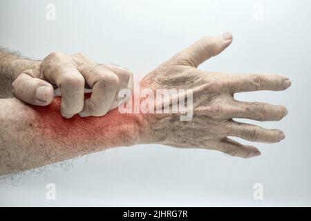 Homme asiatique aîné grattant son avant-bras. Concept de maladies de la ...