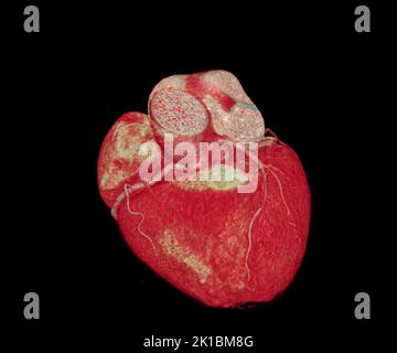 Artère coronaire TDM cardiaque 3D ou CTA montrant des branches ...