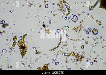 Les champignons et les hyphes sous microscope dans le sol et le compost ...