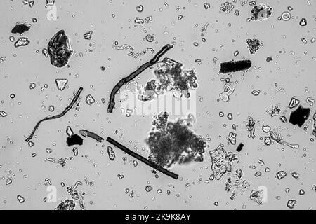 Les champignons et les hyphes sous microscope dans le sol et le compost ...