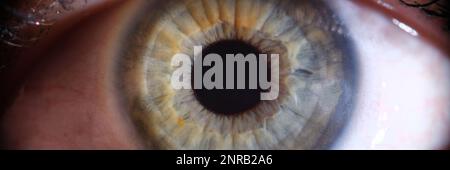 œil rouge enflammé avec lentille de contact, macrophotographie en gros ...