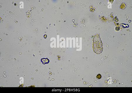 champignons du sol, micro-organismes et nématodes dans un échantillon ...