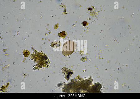champignons du sol, micro-organismes et nématodes dans un échantillon ...