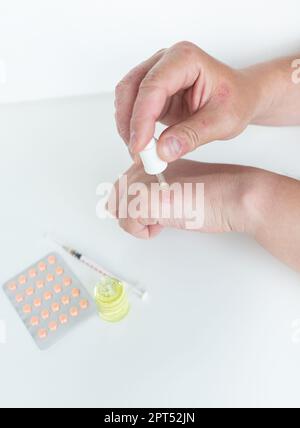 Éruption cutanée et gonflement sur le bras de l'homme, les ...