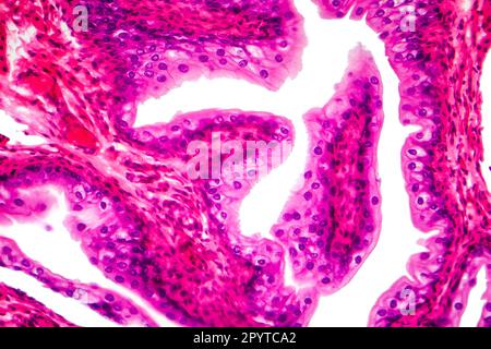 Tissu de transition de l'épithélium de la vessie urinaire sous ...