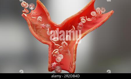Anémie quantité de cellules sanguines ou d'hémoglobine et normale ...