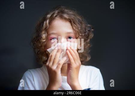 Enfant avec oeil rose gonflé. Infection des yeux et allergie au pollen ...