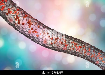 Avec des vaisseaux sanguins, les cellules de sang, vue côté ...