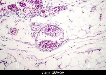 Vaisseaux sanguins avec globules rouges, section transevrse ...