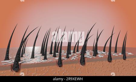 Follicules de cheveux et pellicules sous microscope - 3D illustration ...