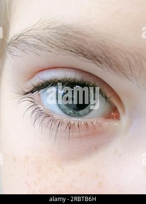 Pupille dilatée. Close-up d'un œil humain avec une pupille dilatée ...