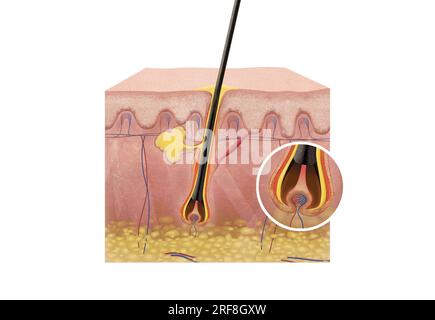 Section de peau 2D avec bouton avec épiderme, derme et hypoderme ...