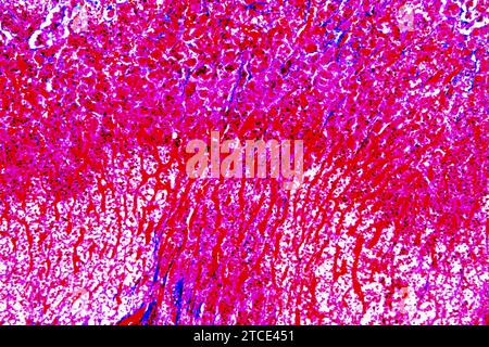 Glande surrénale ou surrénale humaine montrant de la médulla. Produit ...