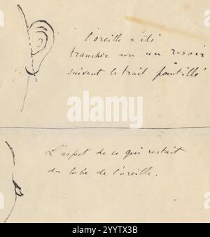 Dessin de la mutilation de Vincent van Gogh's ear Photo Stock - Alamy
