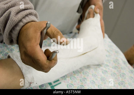 La cheville enflée de femme Photo Stock - Alamy