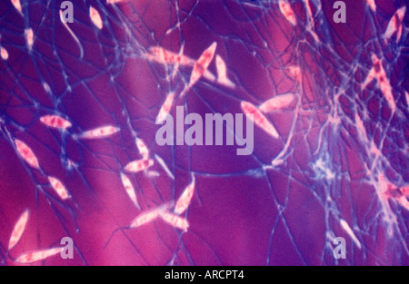 Un est un dermatophyte champignon parasite de la peau Photo Stock - Alamy