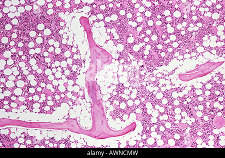 La formation des cellules sanguines (globules rouges de la moelle ...