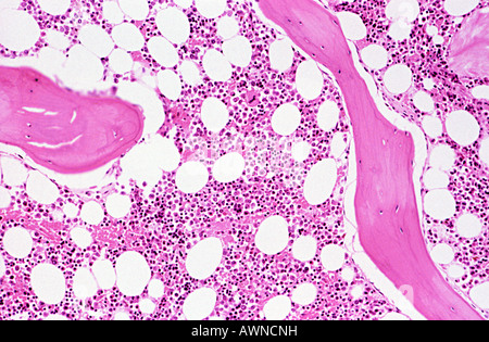 La formation des cellules sanguines (globules rouges de la moelle ...
