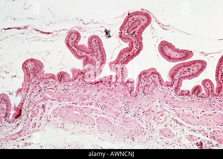 La formation des cellules sanguines (globules rouges de la moelle ...
