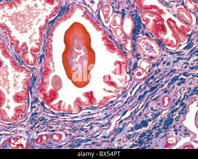 L'anatomie de la prostate chez l'homme Photo Stock - Alamy