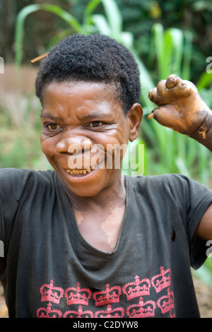 Pygmées un lépreux dans la forêt,la République du Congo Photo Stock - Alamy