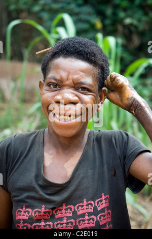 Pygmées un lépreux dans la forêt,la République du Congo Photo Stock - Alamy