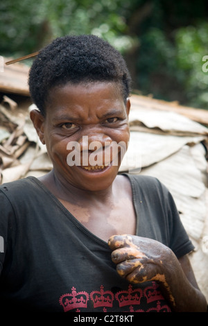 Pygmées un lépreux dans la forêt,la République du Congo Photo Stock - Alamy
