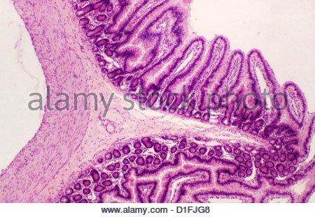 L'intestin grêle. La lumière microphotographie (LM) d'une section à ...
