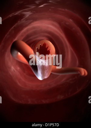 L'ankylostomiase tête. Illustration de l'ordinateur du chef de l ...